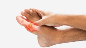 Gout Guide: Causes, Symptoms, Treatments & Prevention Tips - GHHS ...