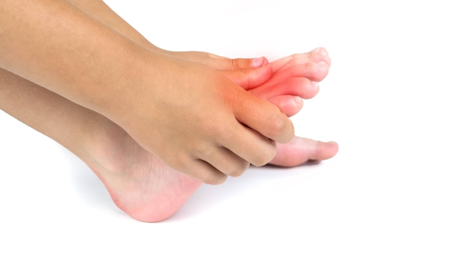 Gout Guide: Causes, Symptoms, Treatments & Prevention Tips - GHHS Healthcare